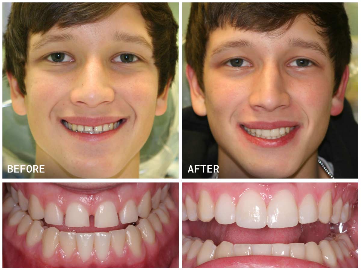Case Studies | GreatSmiles New Jersey | Dr. Michelle Weddle